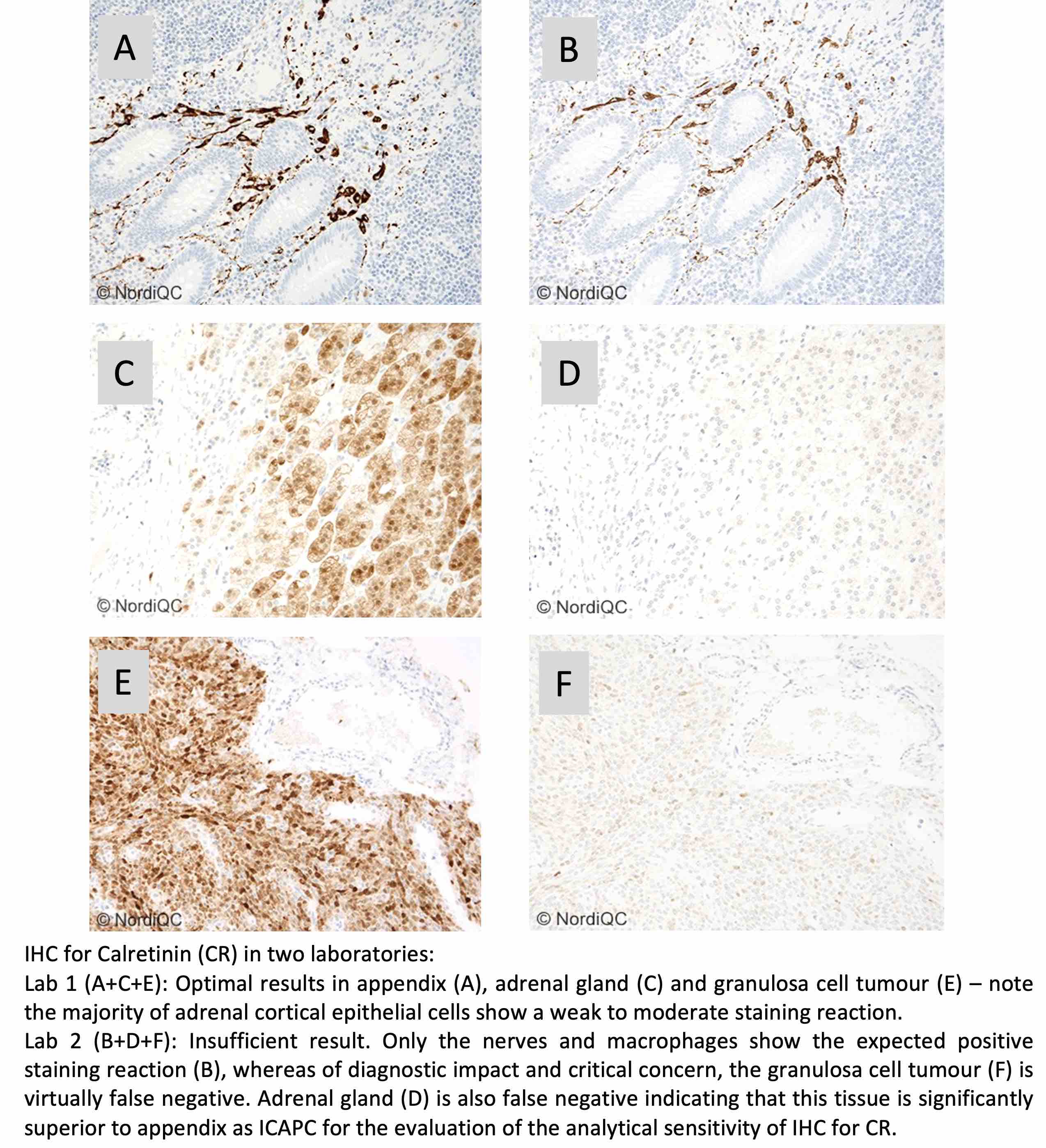 NordiQC - Immunohistochemical Quality Control