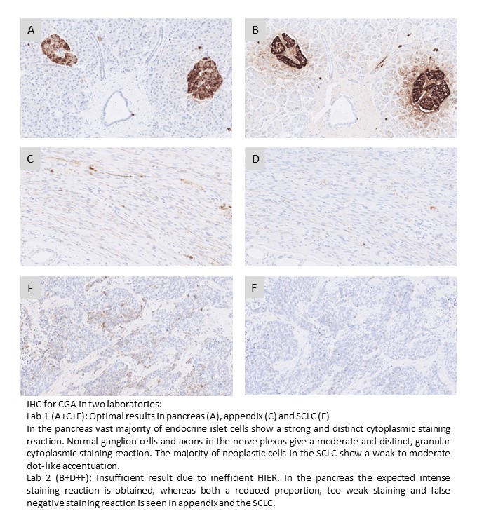 NordiQC - Immunohistochemical Quality Control